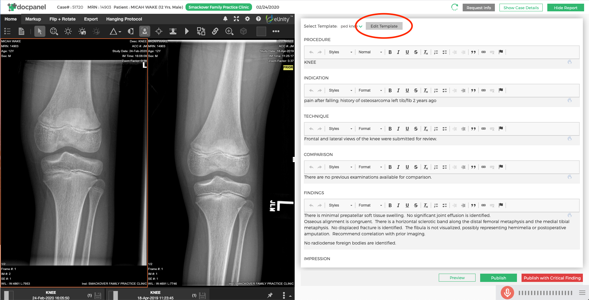How do I create my own report templates? – DocPanel